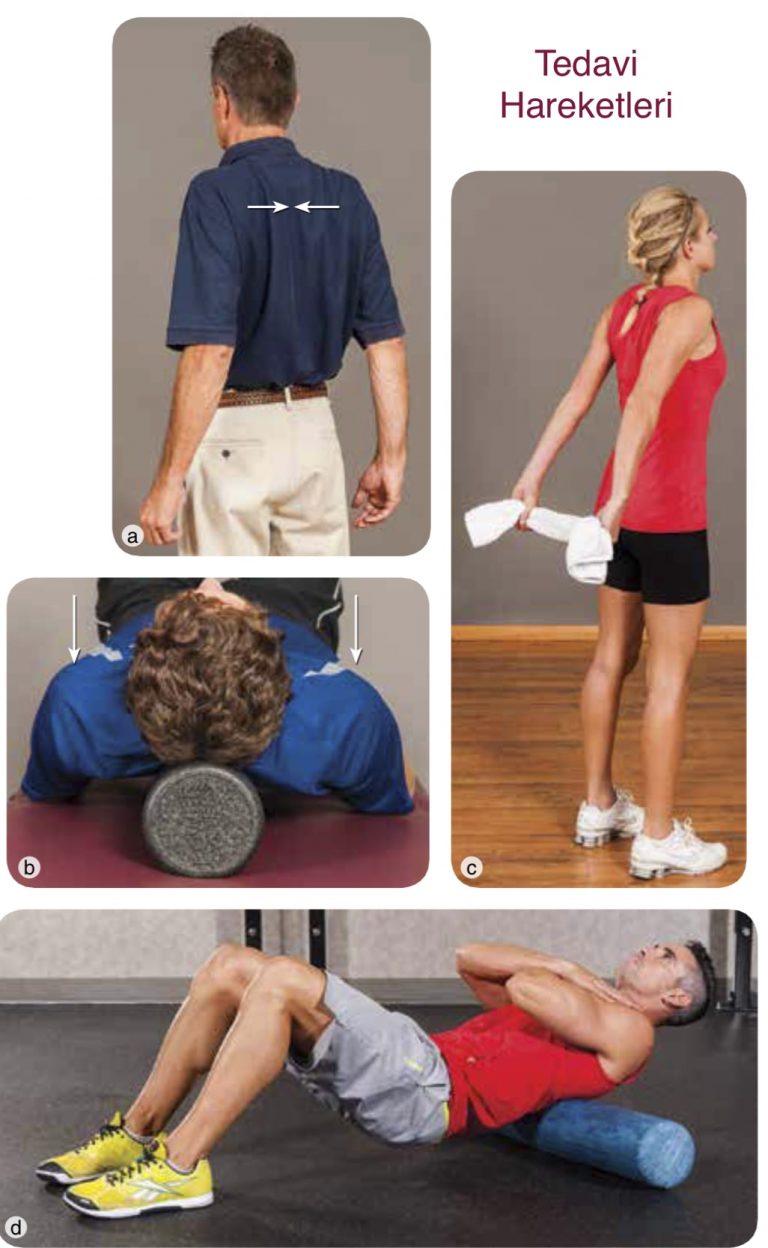 Kyphotic Posture | Therapy, Exercise, Physiotherapy, Correction.